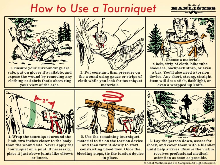 How to Make & Use a Tourniquet: An Illustrated Guide | The Art of Manliness