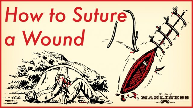 How to Suture a Wound | The Art of Manliness