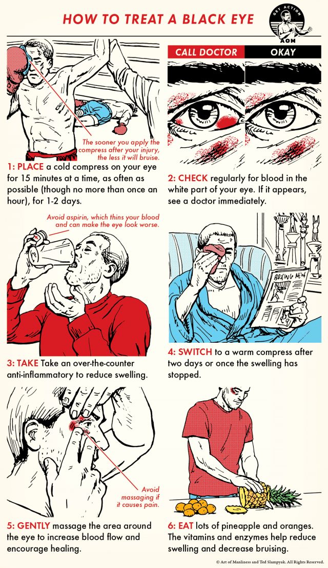 Skill of the Week: Treat a Black Eye | The Art of Manliness