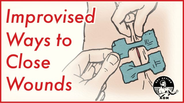 Improvised Ways to Close a Wound | The Art of Manliness